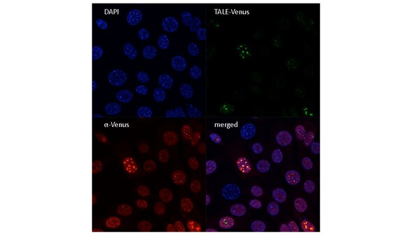 Anti-Venus (YFP/GFP) Antibody, clone 10 | MAB131890-100UG